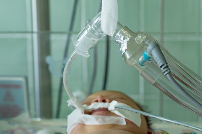 Ventilação Pulmonar Mecânica: Cuidados no Tratamento | Blog do Secad